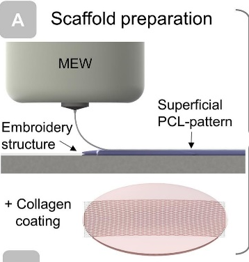 Tendon Reconstruction with the GeSiM BioScaffolder